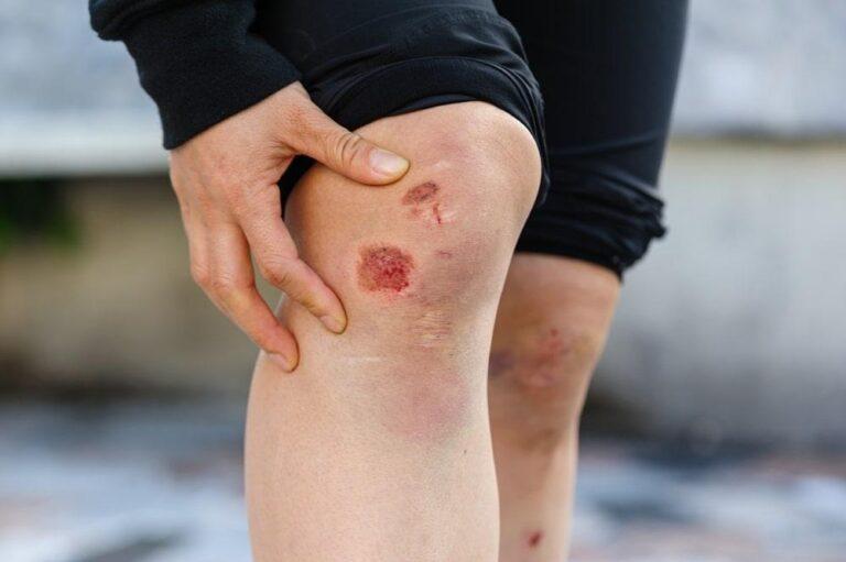 14 Warning Signs of Liver Damage You Shouldn't Ignore | PureHealth Research