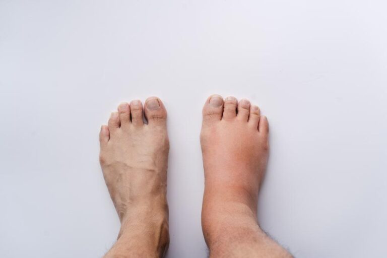 14 Warning Signs of Liver Damage You Shouldn't Ignore | PureHealth Research