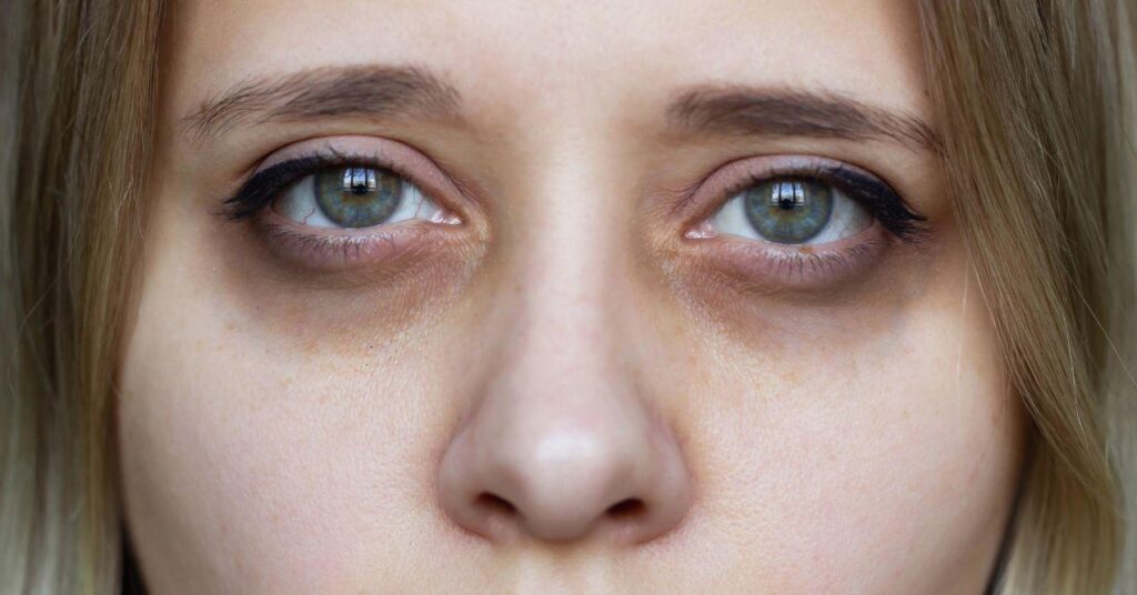 15 Signs You Are Iron Deficient | PureHealth Research