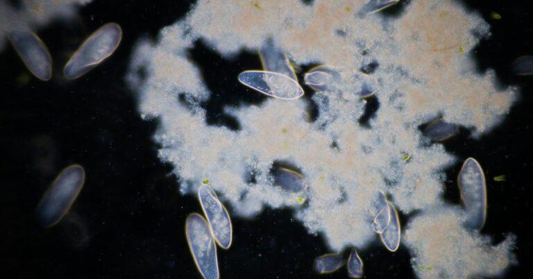 How Long Does Parasite Die-off Symptoms Last? | PureHealth Research