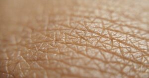 What Vitamin Helps Crepey Skin? | PureHealth Research