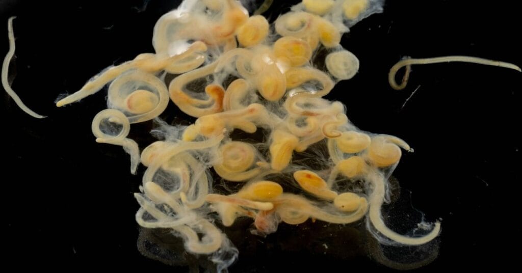 How Long Should You Parasite Cleanse? (Expert Advice) | PureHealth Research