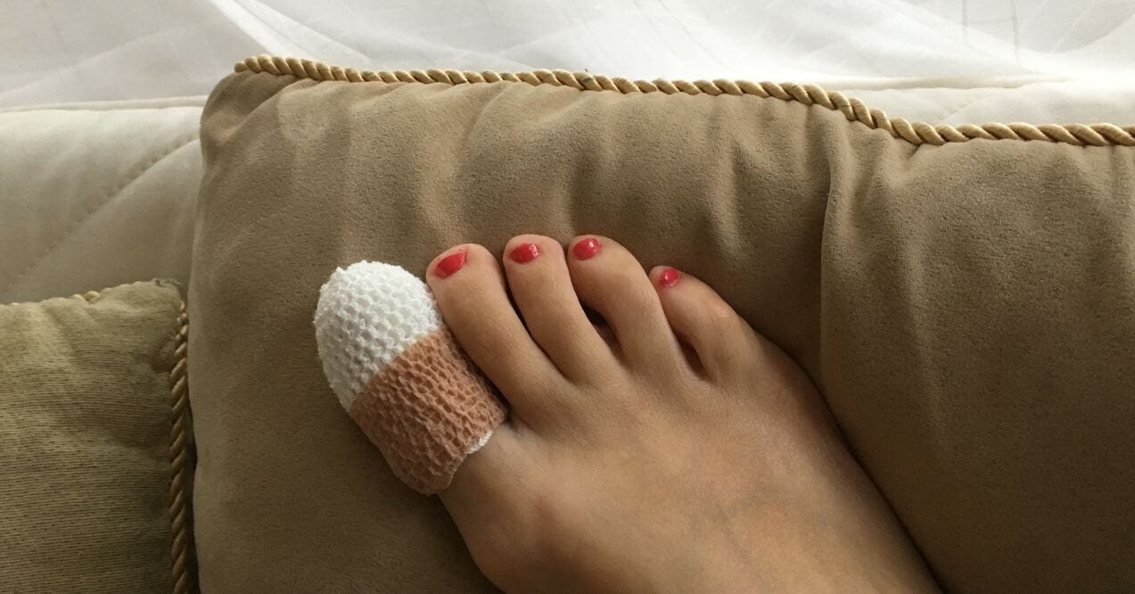 Why Are My Toenails Falling Off? Causes & Prevention | PureHealth Research