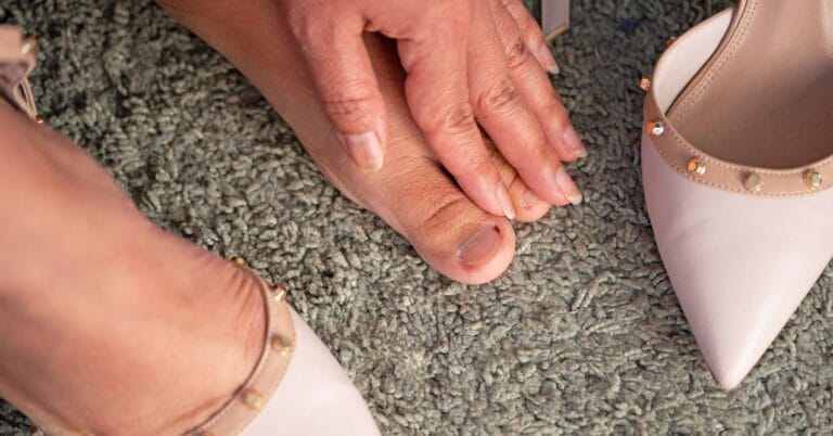 5 Steps How to Fix Nasty Toenails | PureHealth Research