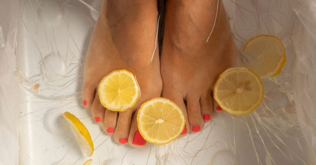 How to Get Rid of Dark Spots on Feet: A Complete Guide | PureHealth ...