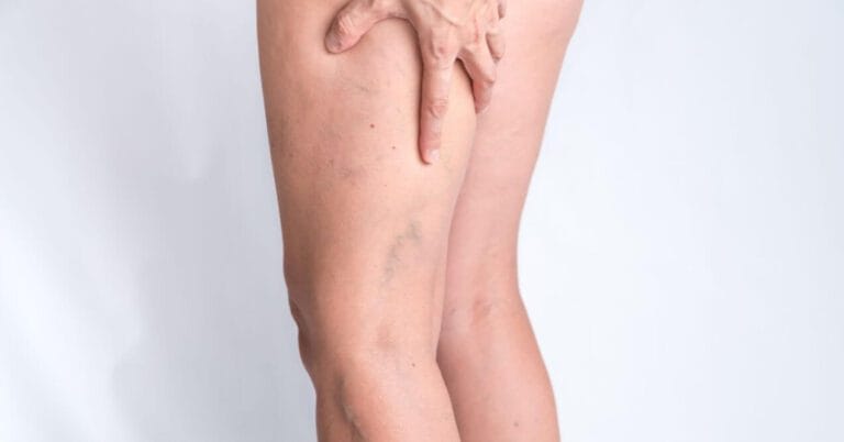 How to Improve Circulation in Feet: 9 Useful Tips | PureHealth Research