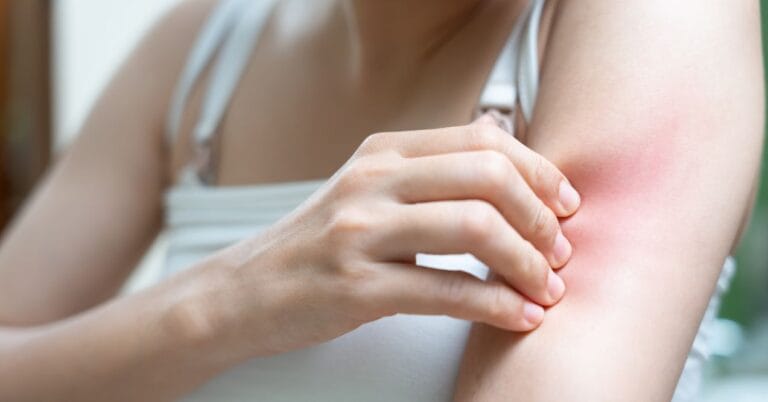 Fructan Intolerance Causes, Symptoms, Solutions + Food List ...