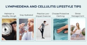 What's the Connection Between Lymphedema and Cellulitis? | PureHealth ...