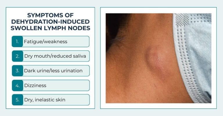 Can Dehydration Cause Swollen Lymph Nodes? | PureHealth Research